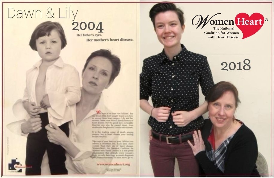 Champion Spotlight: Q&A with Dawn Manogue - WomenHeart
